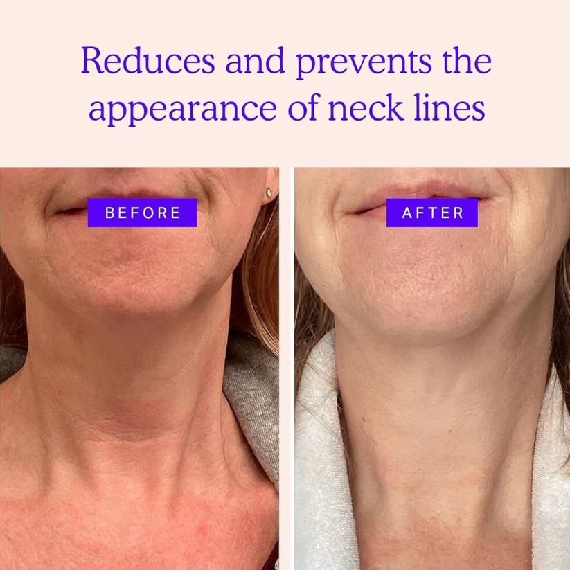 Magec Collagen Fullerene Neck Cream | Tightening & Anti-Wrinkle Formul
