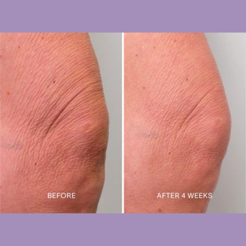 Magec Collagen Fullerene Neck Cream | Tightening & Anti-Wrinkle Formul